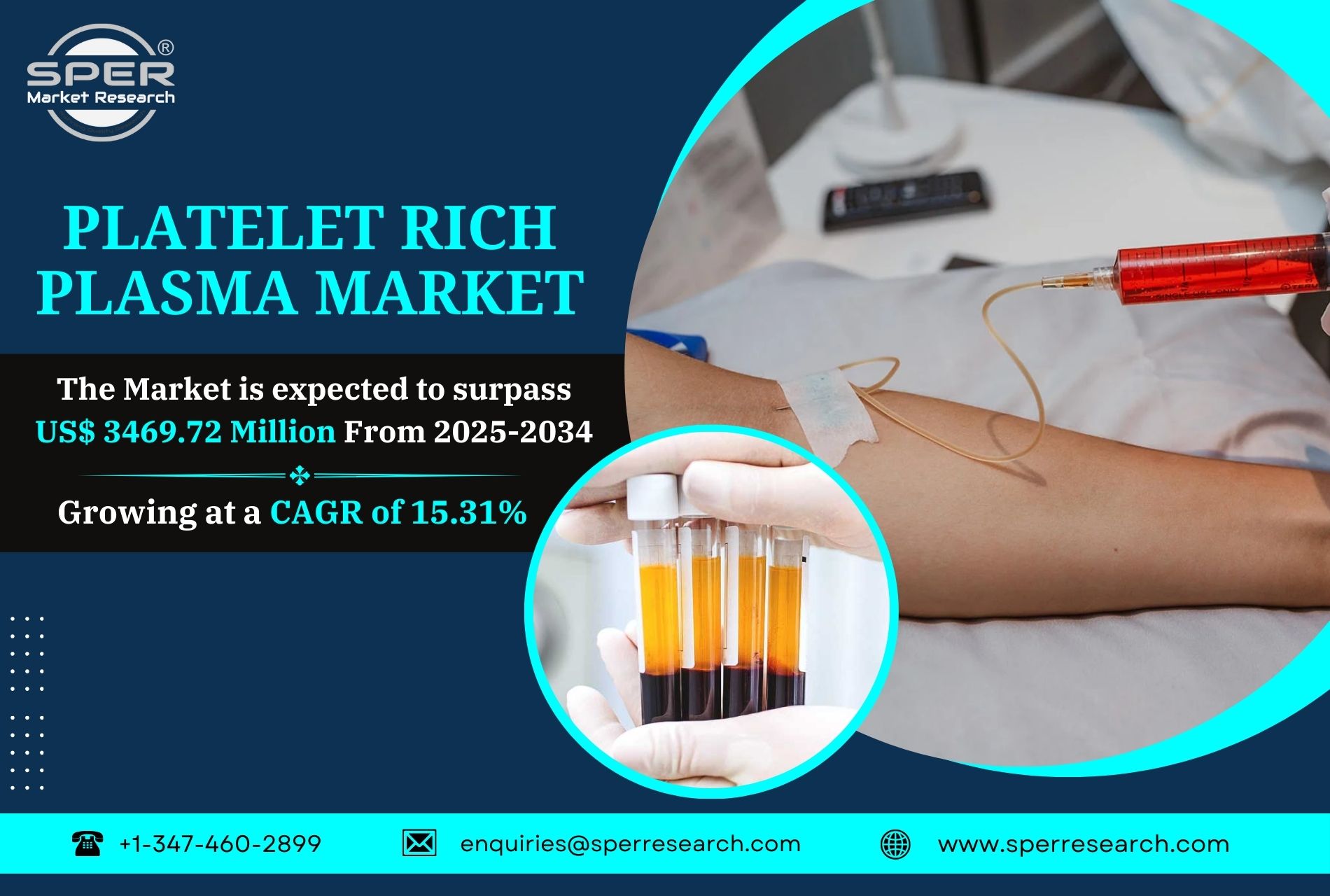 Platelet Rich Plasma Market Share, Scope, Analysis, Competition and ...